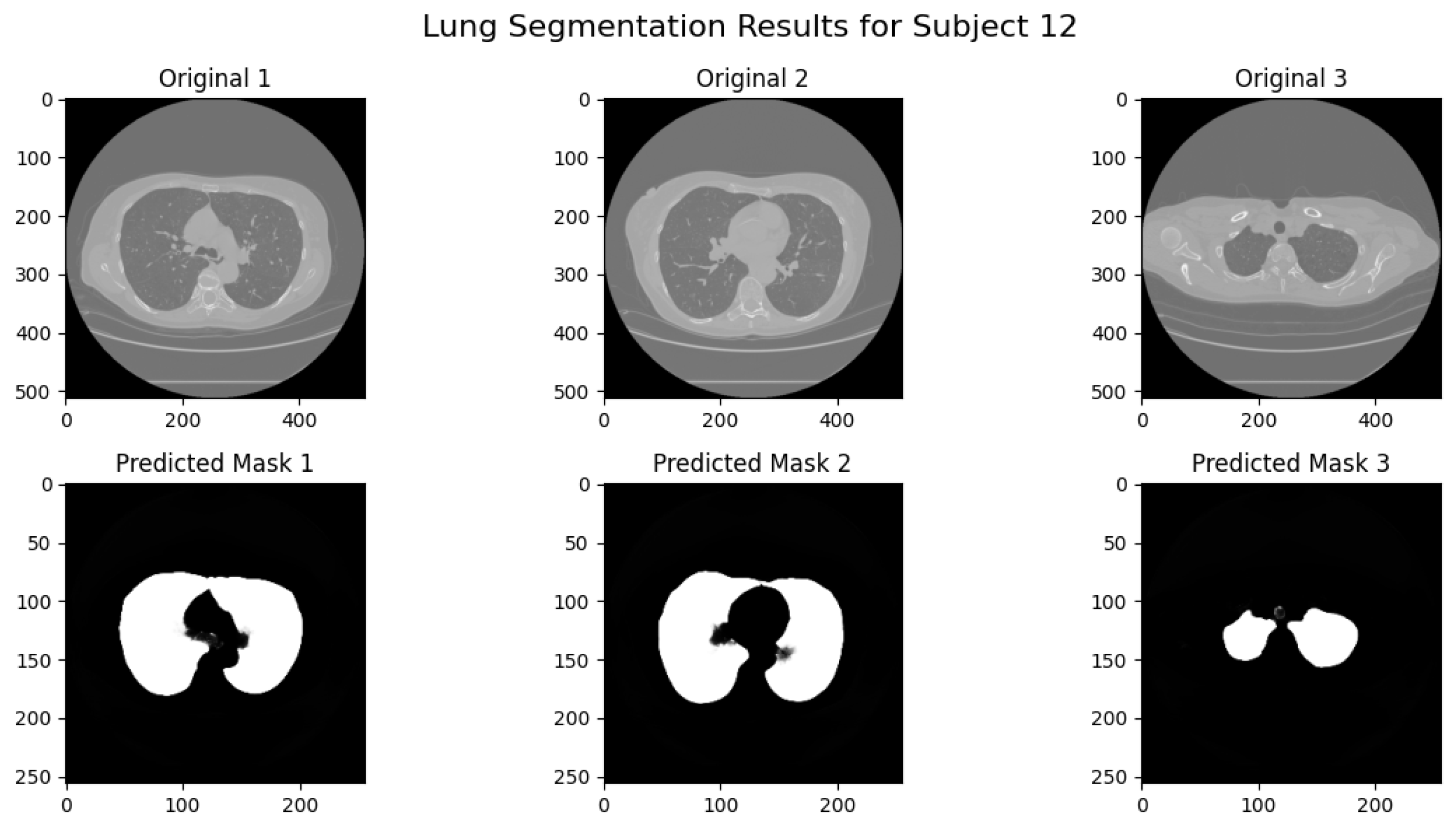 Enhancing U-Net Segmentation Accuracy Through Comprehensive Data Preprocessing