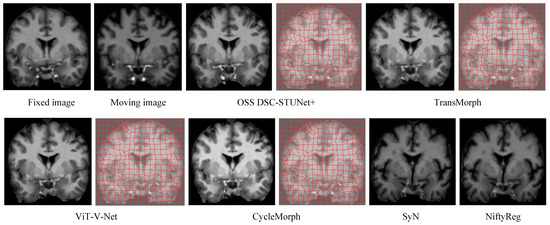 A Novel 3D Magnetic Resonance Imaging Registration Framework Based on ...