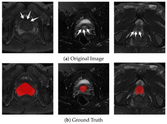 Accurate Prostate Segmentation in Large-Scale Magnetic Resonance Imaging Datasets via First-in ...
