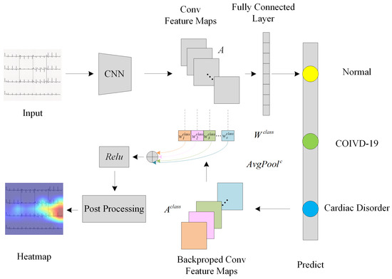 GM-CBAM-ResNet: A Lightweight Deep Learning Network for Diagnosis of ...
