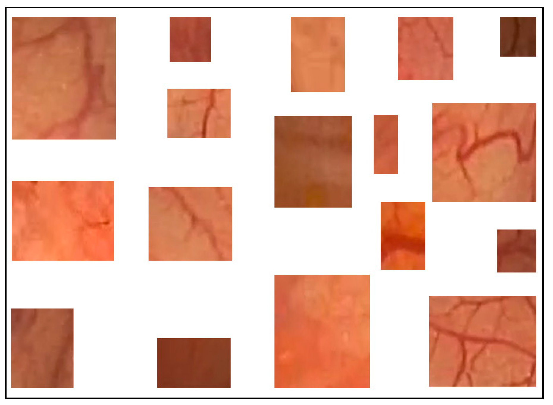 Deep Learning-Based Semantic Segmentation for Objective Colonoscopy Quality Assessment