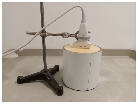 Quantitative Ultrasound Texture Analysis of Breast Tumors: A Comparison ...