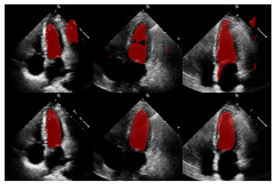 “ShapeNet”: A Shape Regression Convolutional Neural Network Ensemble Applied to the Segmentation ...