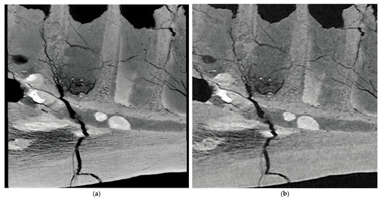 Photon-Counting Detector CT Scan of Dinosaur Fossils: Initial Experience