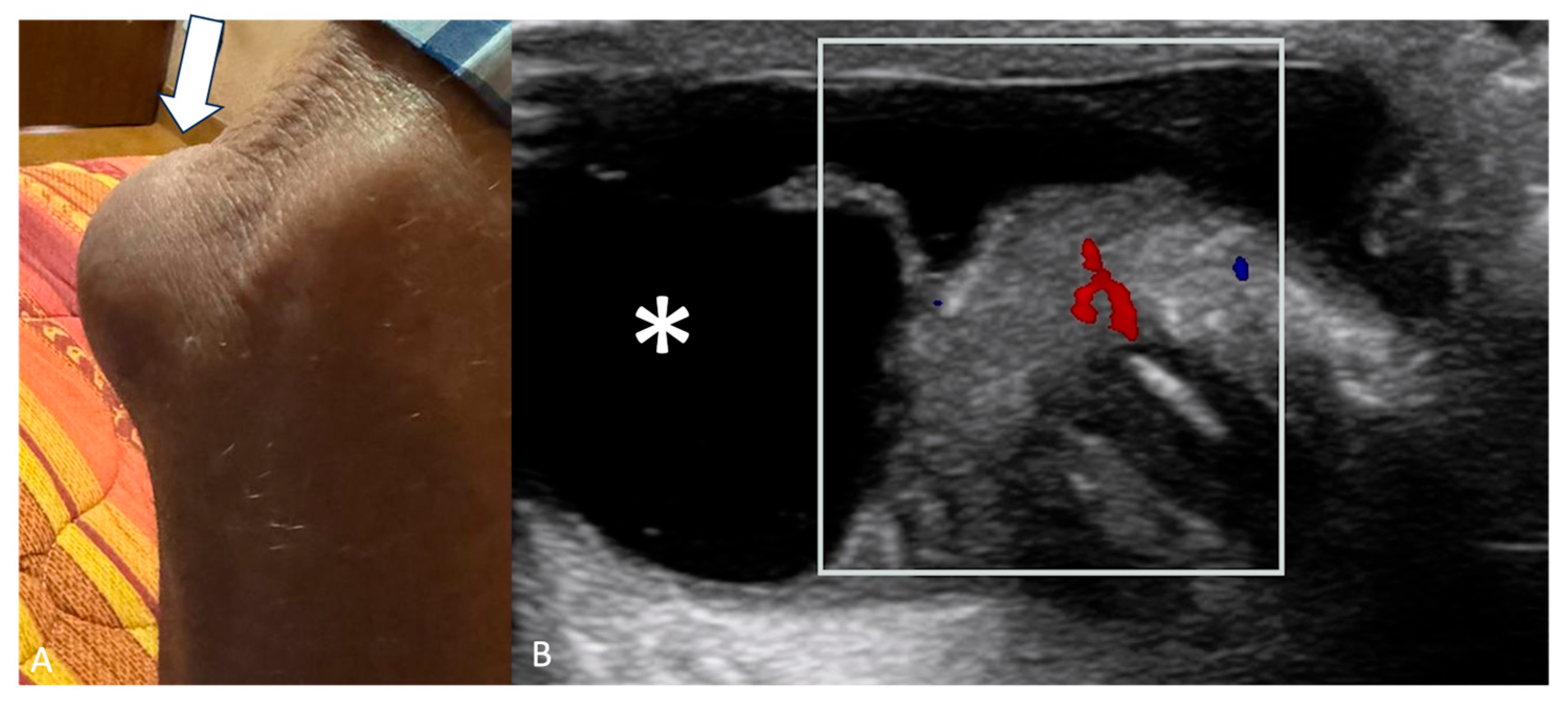 Imaging Evaluation of Periarticular Soft Tissue Masses in the ...