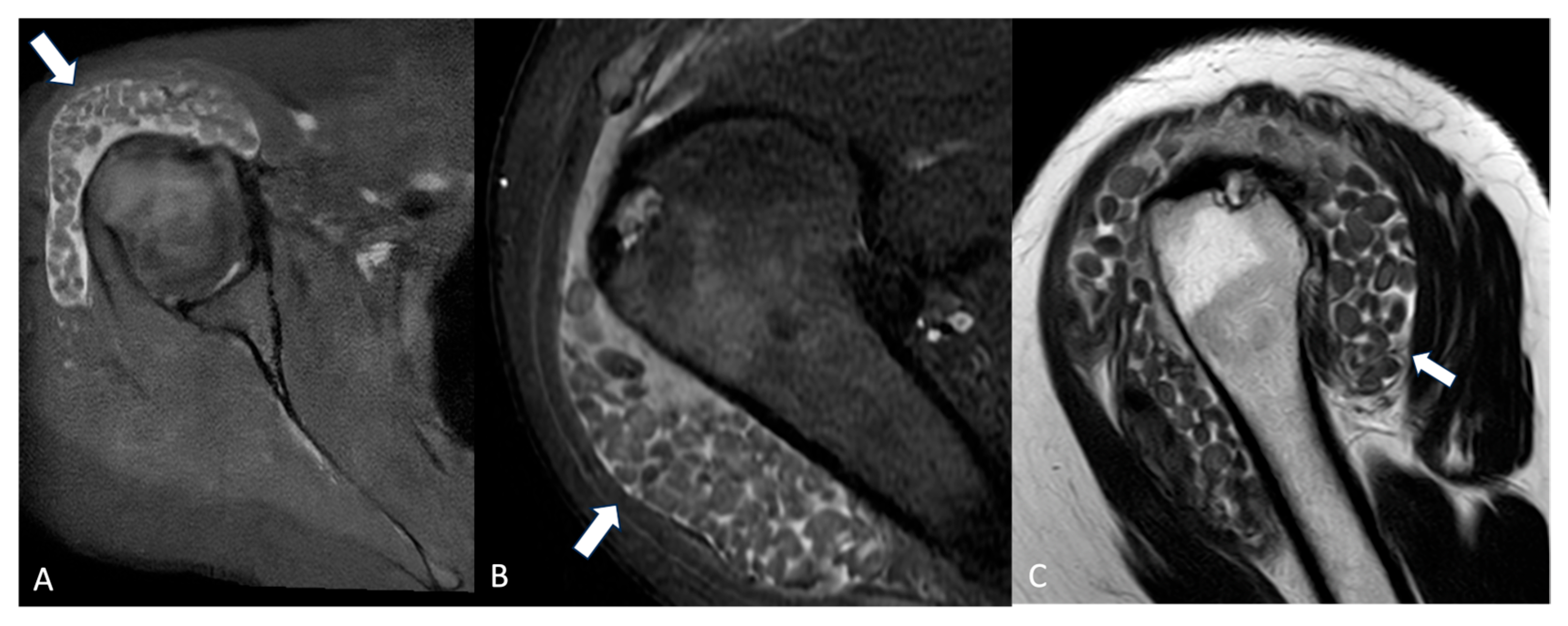 Imaging Evaluation of Periarticular Soft Tissue Masses in the ...
