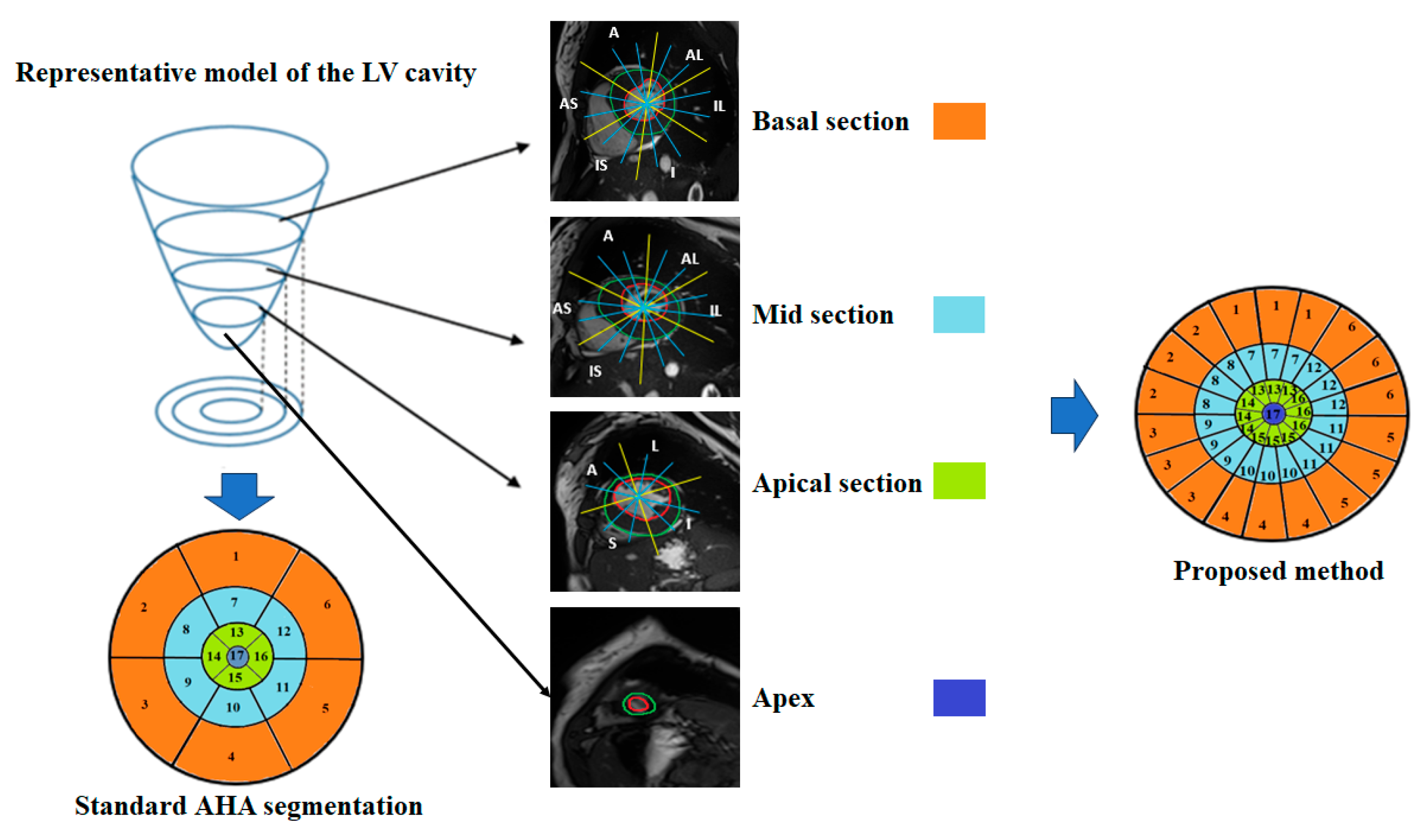 Deep Learning Based Algorithm For The Classification Of Left Ventricle