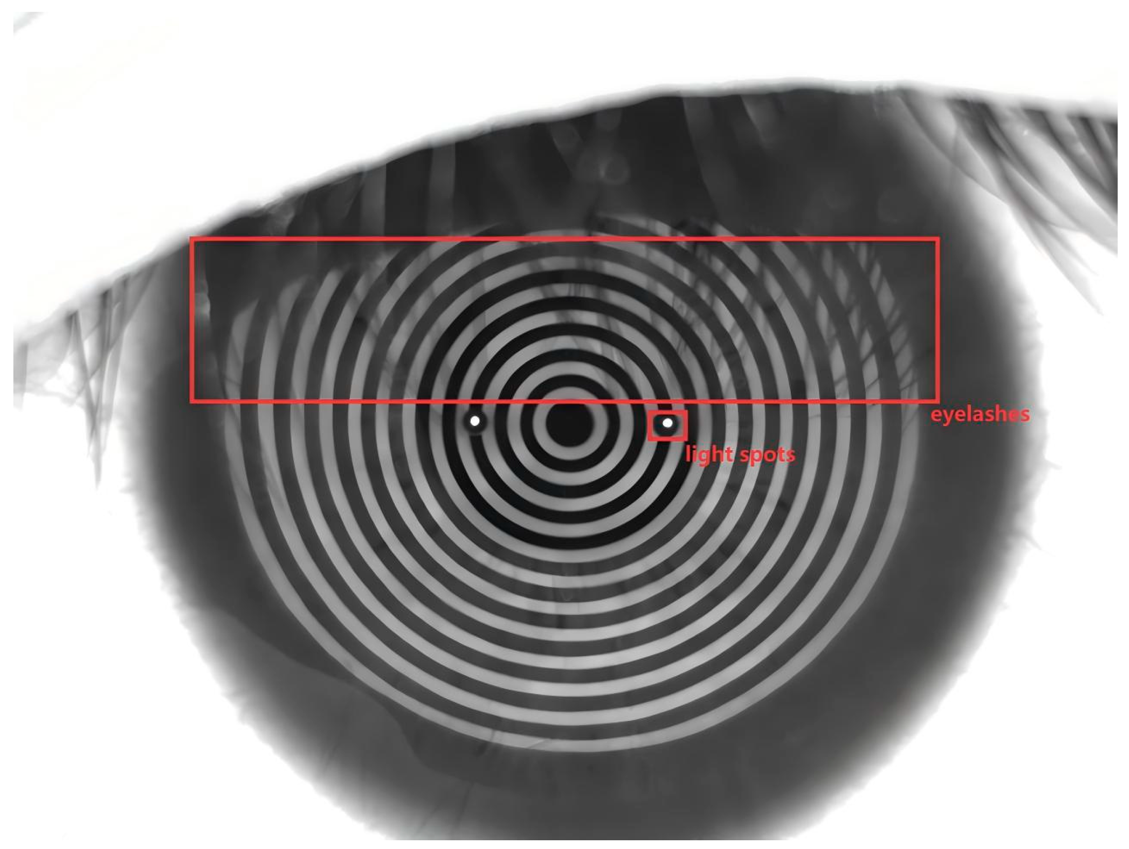 Placido Sub-Pixel Edge Detection Algorithm Based on Enhanced Mexican Hat Wavelet Transform and ...