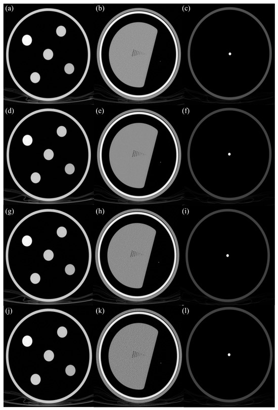 Quantitative Evaluation of Low-Dose CT Image Quality Using Deep ...