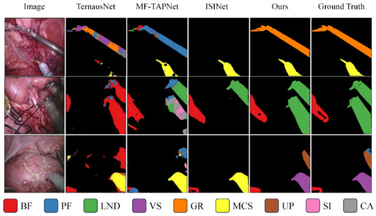 Surgical Instrument Segmentation via Segment-Then-Classify Framework ...