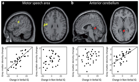 Intelligence as a Developing Function: A Neuroconstructivist Approach