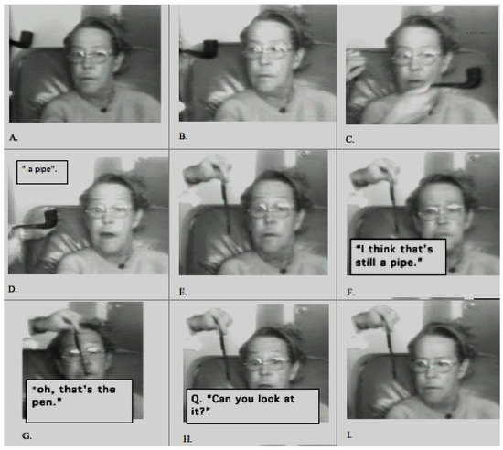 Seeing without a Scene: Neurological Observations on the Origin and ...