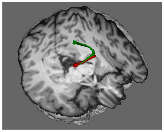 Seeing without a Scene: Neurological Observations on the Origin and ...