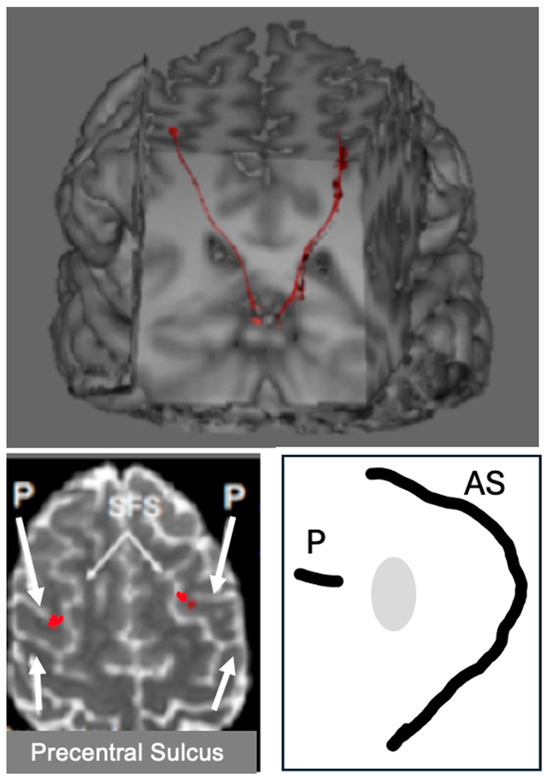 Seeing without a Scene: Neurological Observations on the Origin and ...
