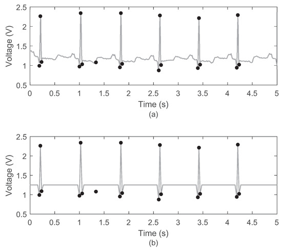 Reconfigurable Analog Preprocessing for Efficient Asynchronous Analog-to-Digital Conversion
