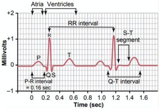 FPGA-Based Decision Support System for ECG Analysis