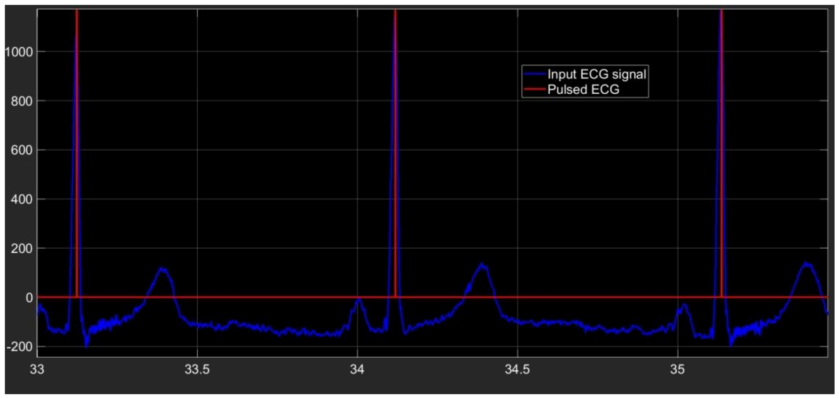 FPGA-Based Decision Support System for ECG Analysis