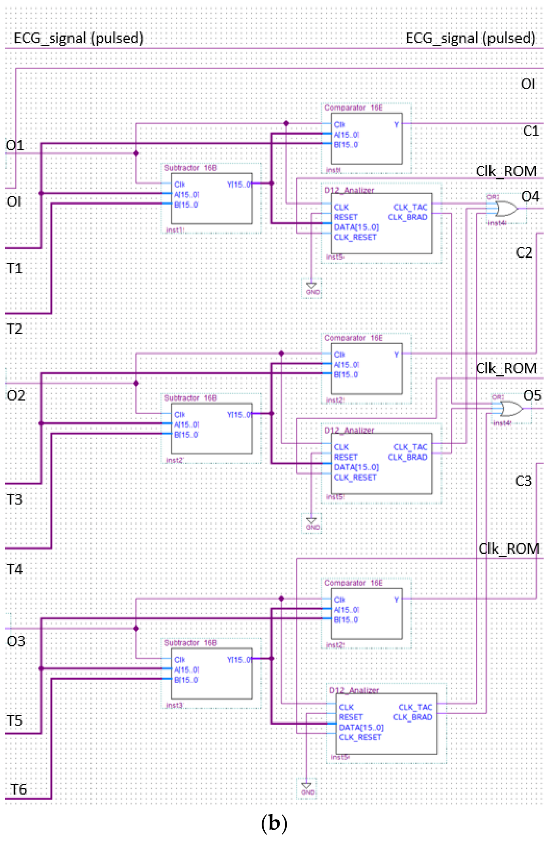 FPGA-Based Decision Support System for ECG Analysis