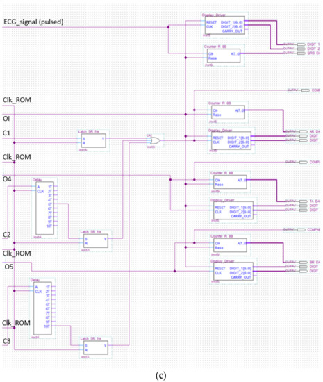 FPGA-Based Decision Support System for ECG Analysis