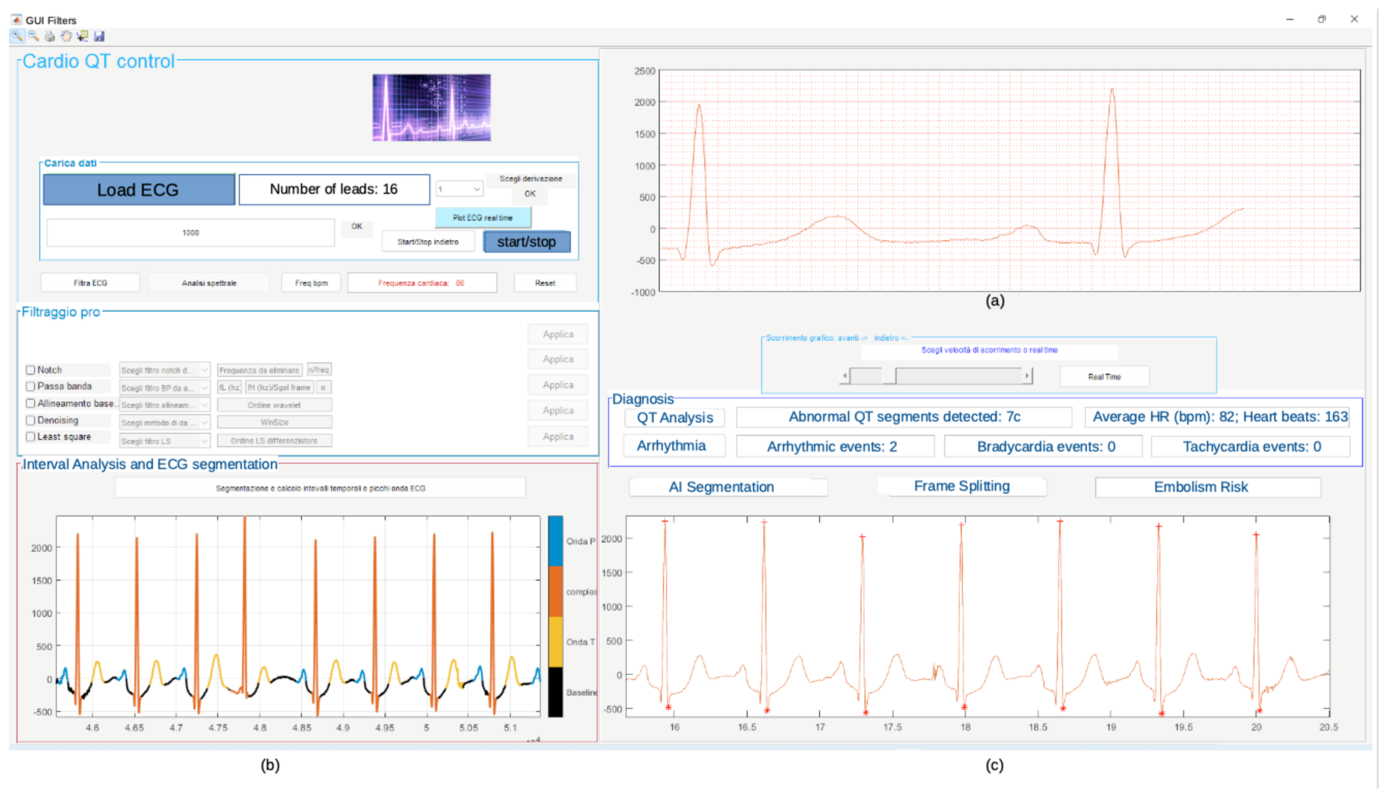FPGA-Based Decision Support System for ECG Analysis