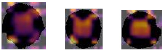 An Objective Metallographic Analysis Approach Based on Advanced Image Processing Techniques