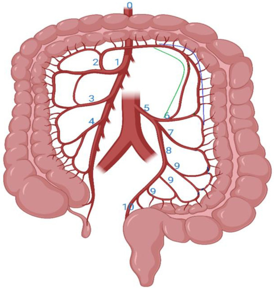 Arterial Vascularization of the Colon; A Guide to Surgical Resection