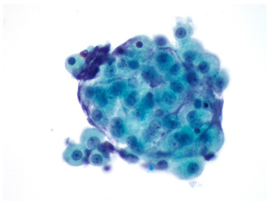 Practical Applications of Molecular Testing in the Cytologic Diagnosis ...