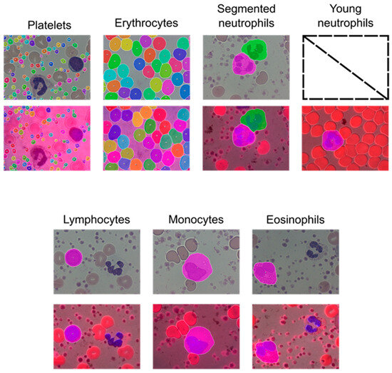 JMP | Free Full-Text | AI-Enhanced Blood Cell Recognition and Analysis ...