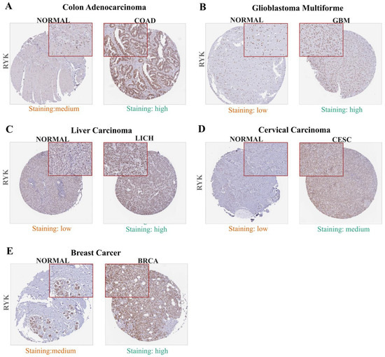 Delving into the Role of Receptor-like Tyrosine Kinase (RYK) in Cancer ...