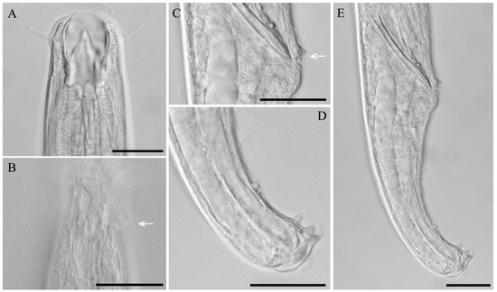 Oncholaimus tripapillatus sp. nov., a New Free-Living Marine Nematode ...