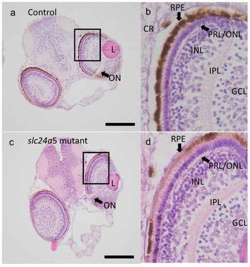 TALEN-Mediated Gene Editing of slc24a5 (Solute Carrier Family 24 ...