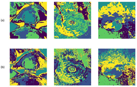 Underwater Image Enhancement Based on Color Correction and Detail ...