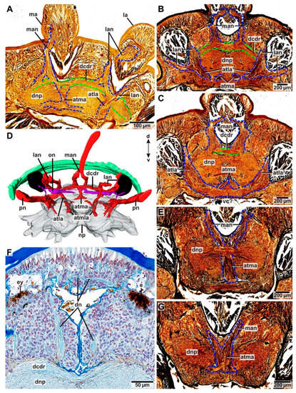 How Do Prostomial Sensory Organs Affect Brain Anatomy? Phylogenetic ...