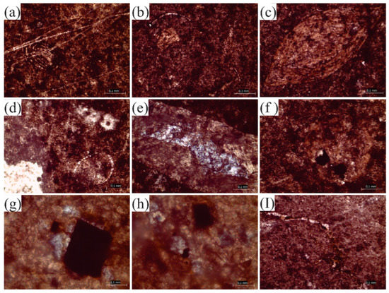 Sedimentology and Diagenesis of the Early–Middle Eocene Carbonate ...
