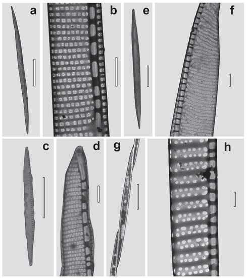 Changes in the Composition of Bloom-Forming Toxic Pseudo-nitzschia ...