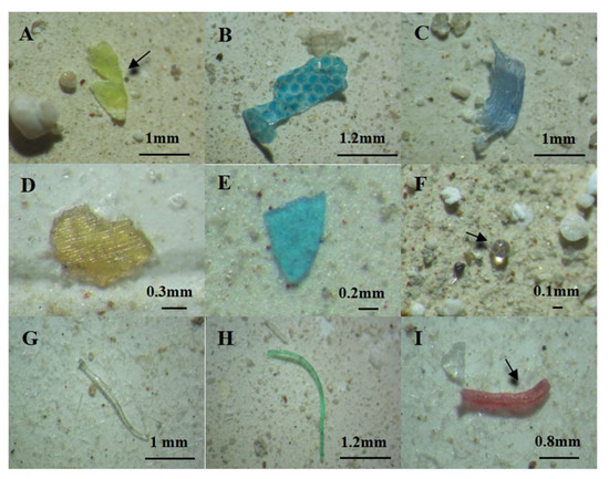 Microplastic Pollution and Its Potential Correlation with Environmental ...