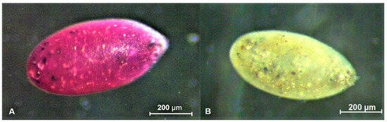 Psammophaga secriensia sp. nov., a New Monothalamid Foraminifera ...