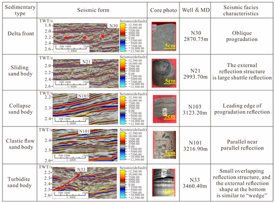 Sedimentary Characteristics and Model of Lacustrine Deep Water Gravity ...