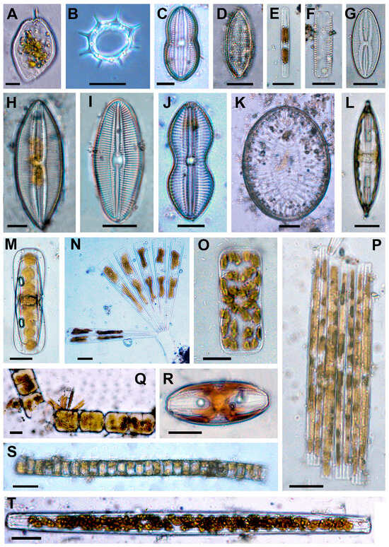 Seasonal Dynamics of Microphytobenthos Distribution in Three Ecotopes ...