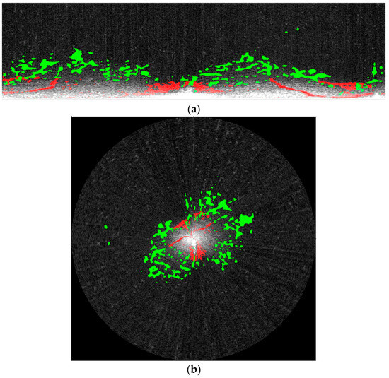 Marine Radar Oil Spill Detection Method Based on YOLOv8 and SA_PSO