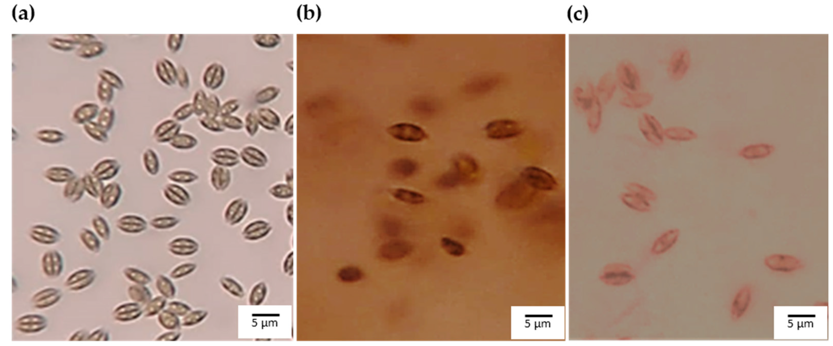 Microbial Mat Dominated by Amphora spp. and Their Adaptative Strategies ...