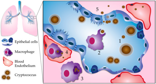 Mechanisms of Pulmonary Escape and Dissemination by Cryptococcus neoformans