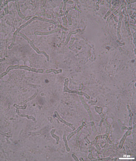 Dermatophytes and Dermatophytosis in Cluj-Napoca, Romania—A 4-Year ...