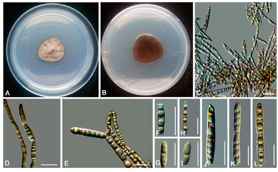 Unveiling the Hidden Diversity of Rock-Inhabiting Fungi ...