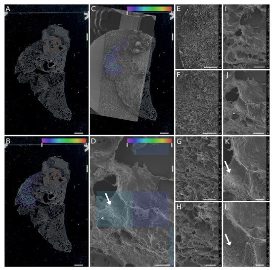 Bringing SEM and MSI Closer Than Ever Before: Visualizing Aspergillus ...