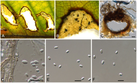Identification and Characterization of Leaf-Inhabiting Fungi from ...