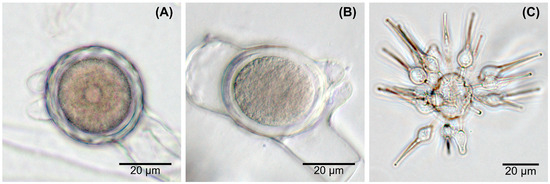 Differentiation of Basidiobolus spp. Isolates: RFLP of a Diagnostic PCR ...