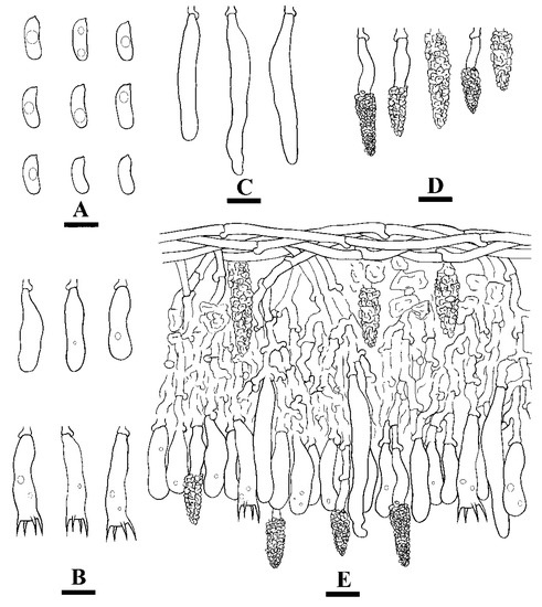 Taxonomy and Phylogeny of the Wood-Inhabiting Fungal Genus Hyphoderma ...