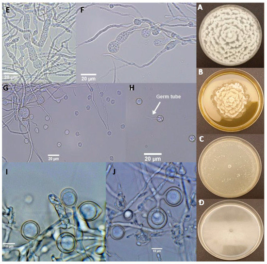 Pathogenicity and Host Range of Pythium kashmirense—A Soil-Borne ...
