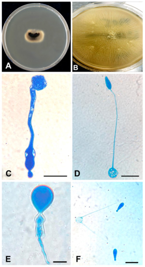 Basidiobolus omanensis sp. nov. Causing Angioinvasive Abdominal ...
